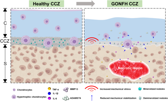 Calcified Cartilage Zone Remodeling Induced by IL-1β Derived from ...