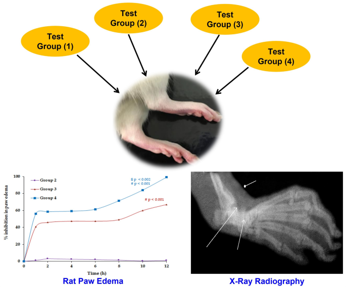 Anti-inflammatory efficacy of a novel diclofenac-loaded liposomal gel ...