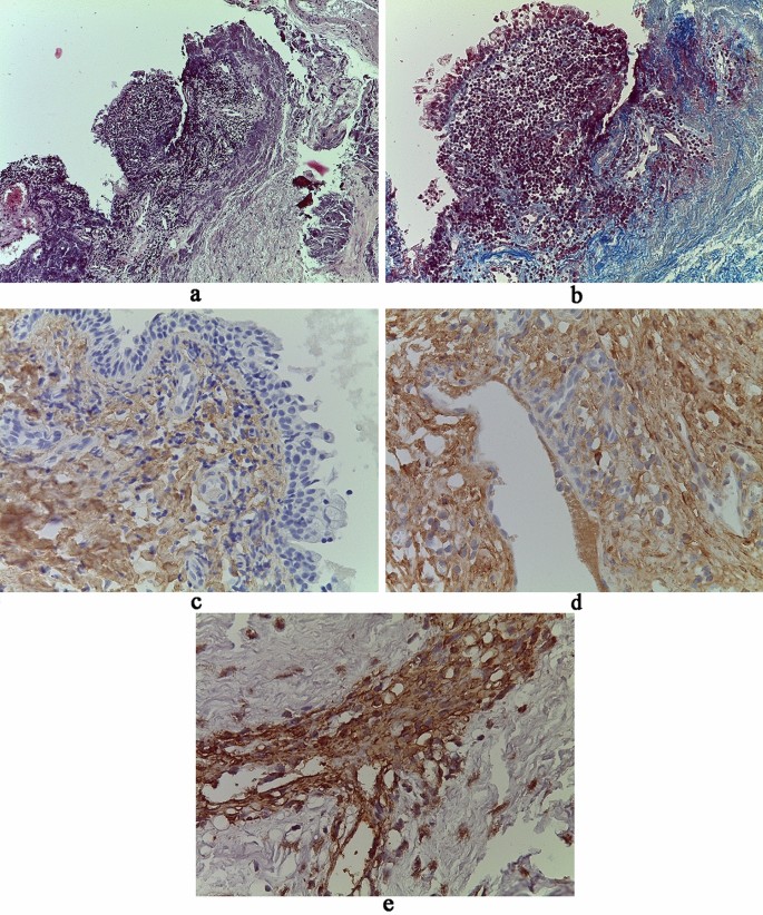 Association of morphologic pattern and biometric characteristics of the ...
