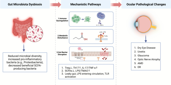 The gut-eye axis in blinding eye diseases: microbiota-driven immune ...