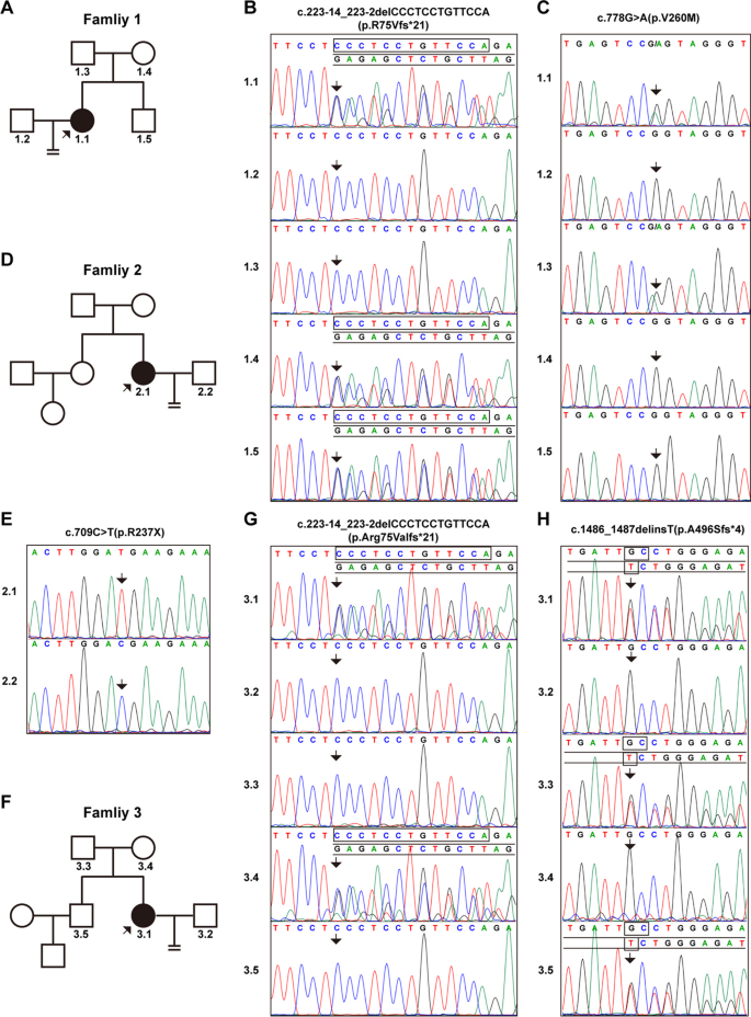 Novel PATL2 variants cause female infertility with oocyte maturation defect | Journal of ...