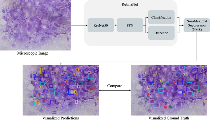 Artificial intelligence interpretation of touch print smear cytology of ...