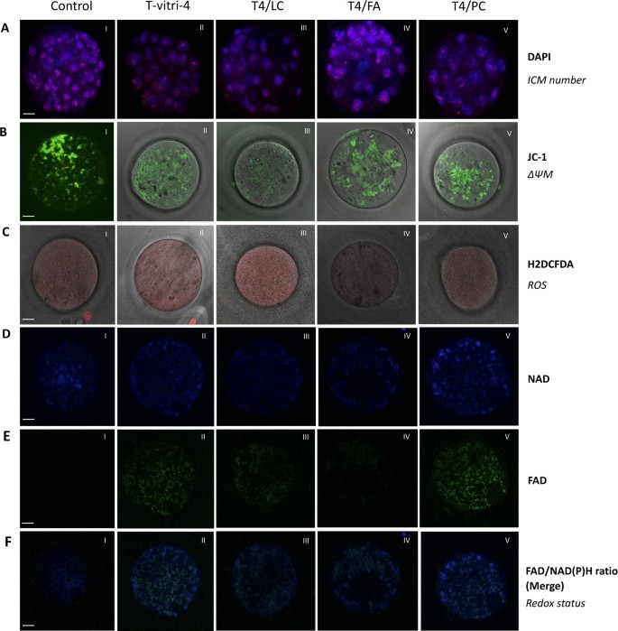 Fatty acids and l-carnitine supplementation in vitrification media ...