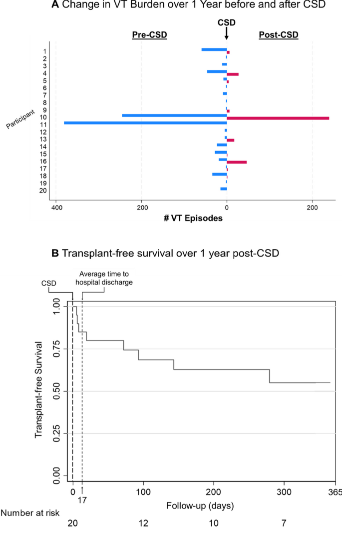 Safety and outcomes of surgical cardiac sympathetic denervation when ...