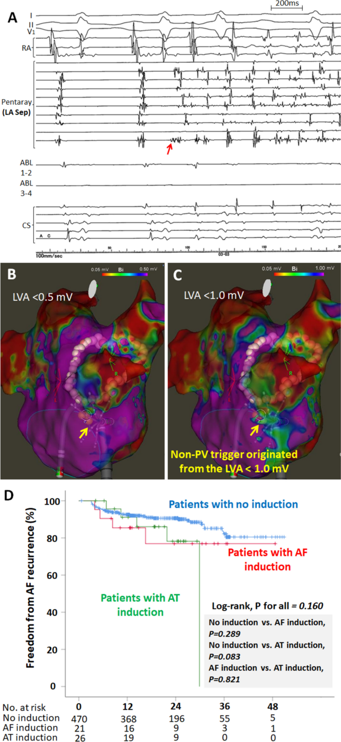 Clinical relevance of left atrial structural remodeling and non ...