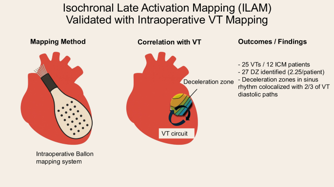 Isochronal late activation mapping in ischemic scar VT: an independent ...
