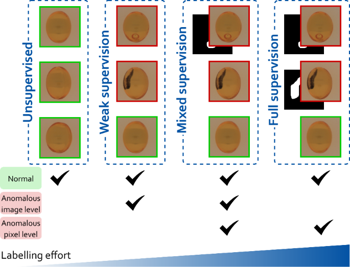 No label left behind: a unified surface defect detection model for all supervision regimes ...