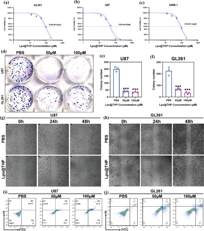 Liposome modification THP boosts glioma ferroptosis and immunogenic ...