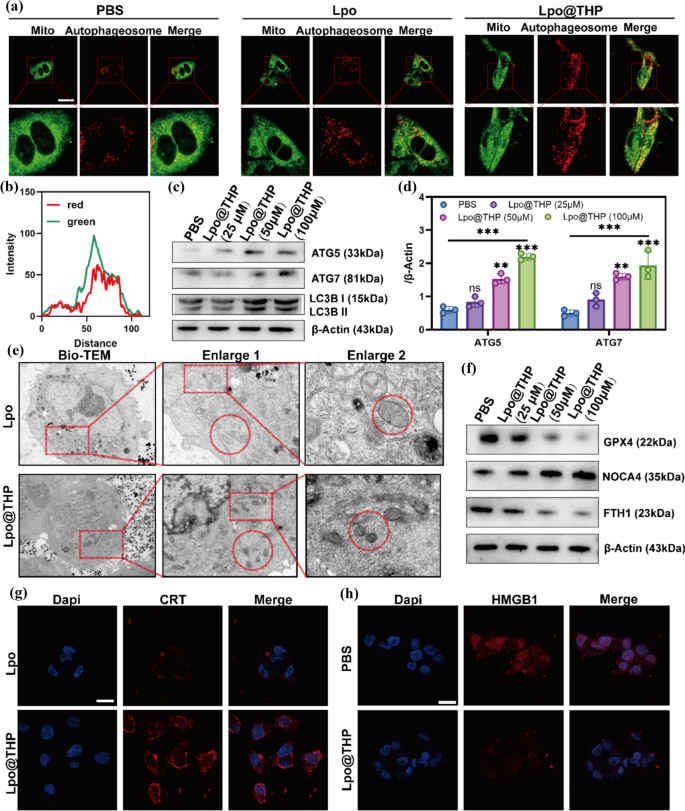 Liposome modification THP boosts glioma ferroptosis and immunogenic ...