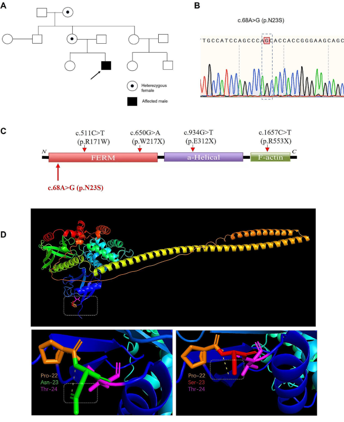 Novel Mutation in the Moesin (MSN) Gene Leads to Immunodeficiency with ...