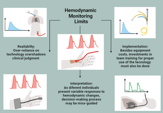 Monitor smart, use better: the future of haemodynamic monitoring ...