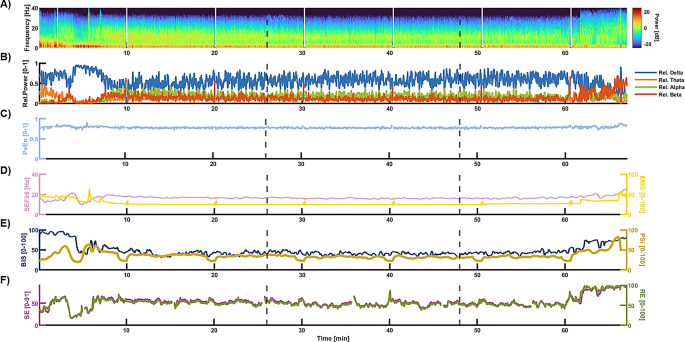 Effect of rocuronium and sugammadex under stable propofol-remifentanil ...