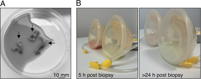 Little women: the relevance and reliance on mouse models for mammary ...
