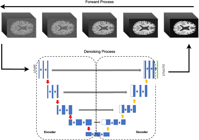 Diffusion Models for Neuroimaging Data Augmentation: Assessing Realism and Clinical Relevance ...