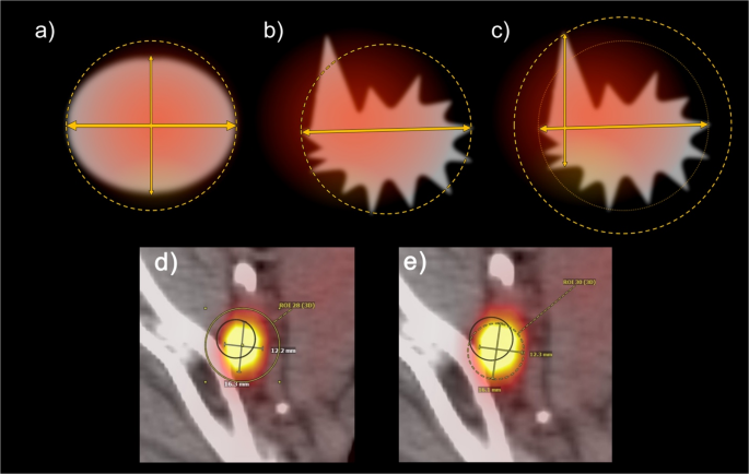 Implementing a Combined Lesion Measurement Tool in Hybrid PET Imaging ...