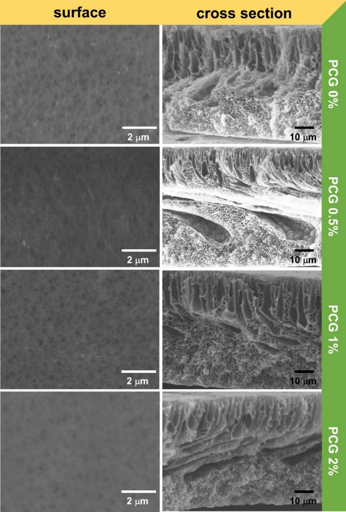 High Selectivity and Reusability of PVDF/Cellulose-GPTMS Membrane ...