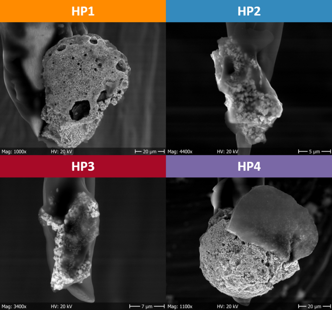Characterisation of individual micron sized nuclear weapons fragments ...