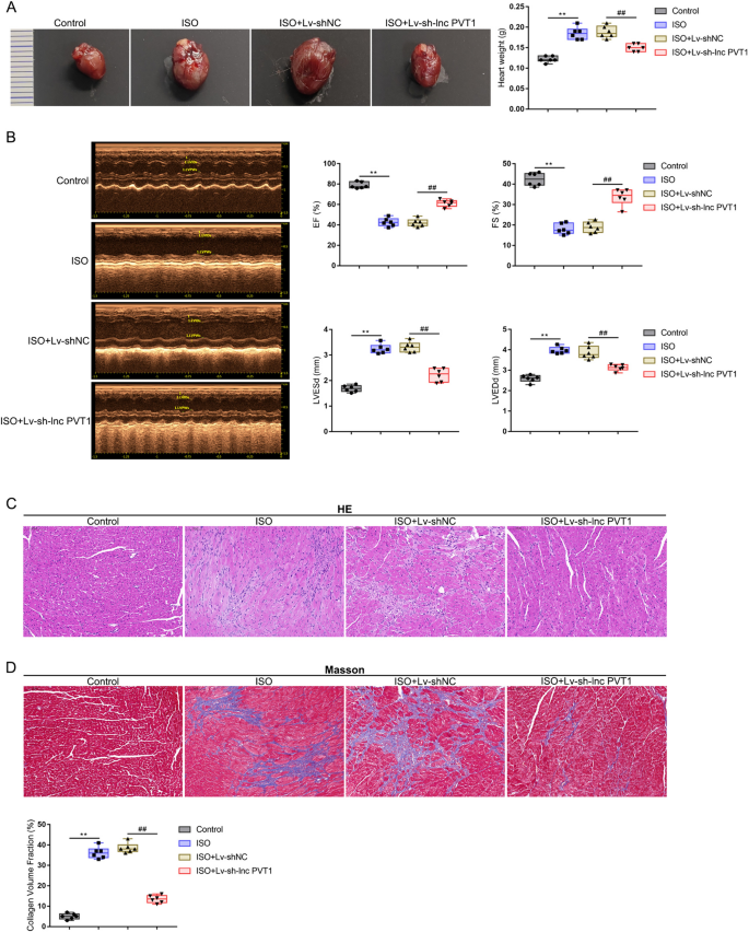 Lnc PVT1 facilitates TGF-β1-induced human cardiac fibroblast activation ...