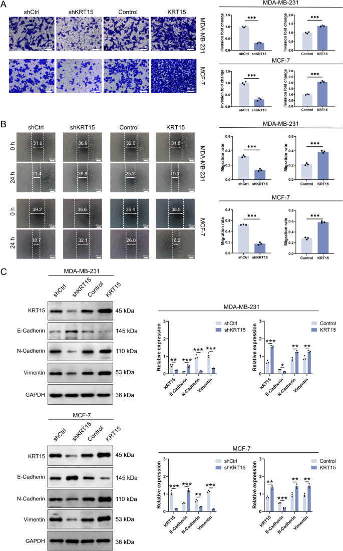 Keratin 15 promotes tumor growth, invasion, epithelial–mesenchymal ...