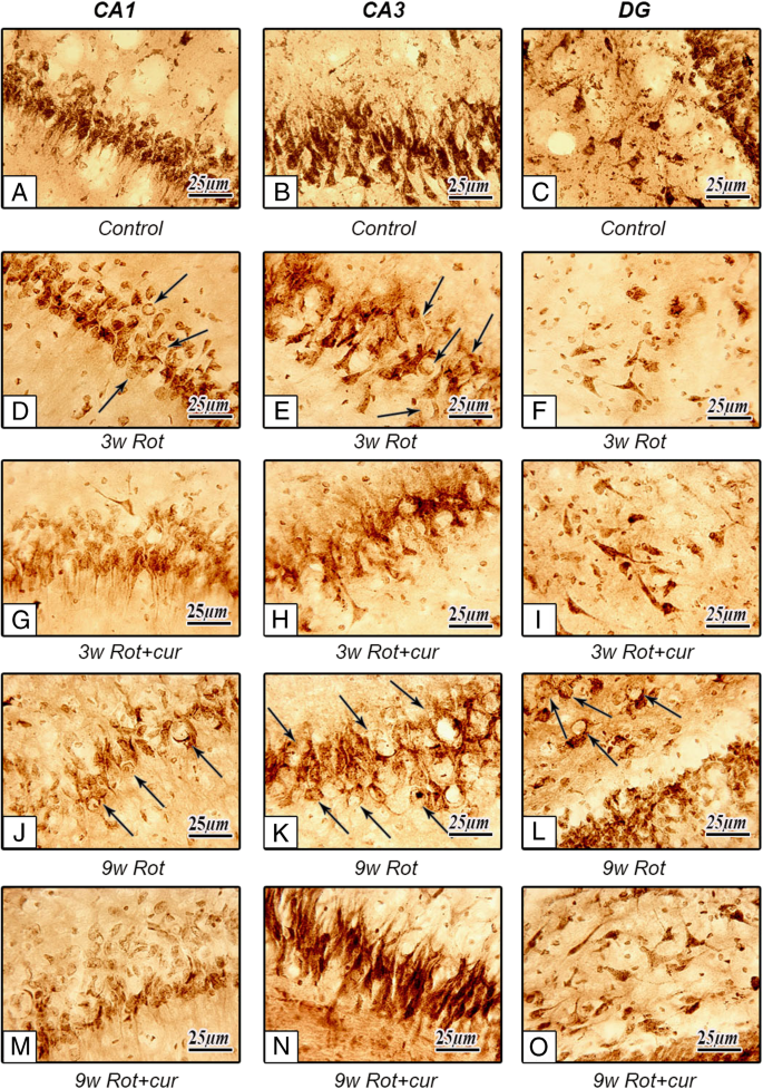 Curcumin treatment reduces motor impairments and protects against ...