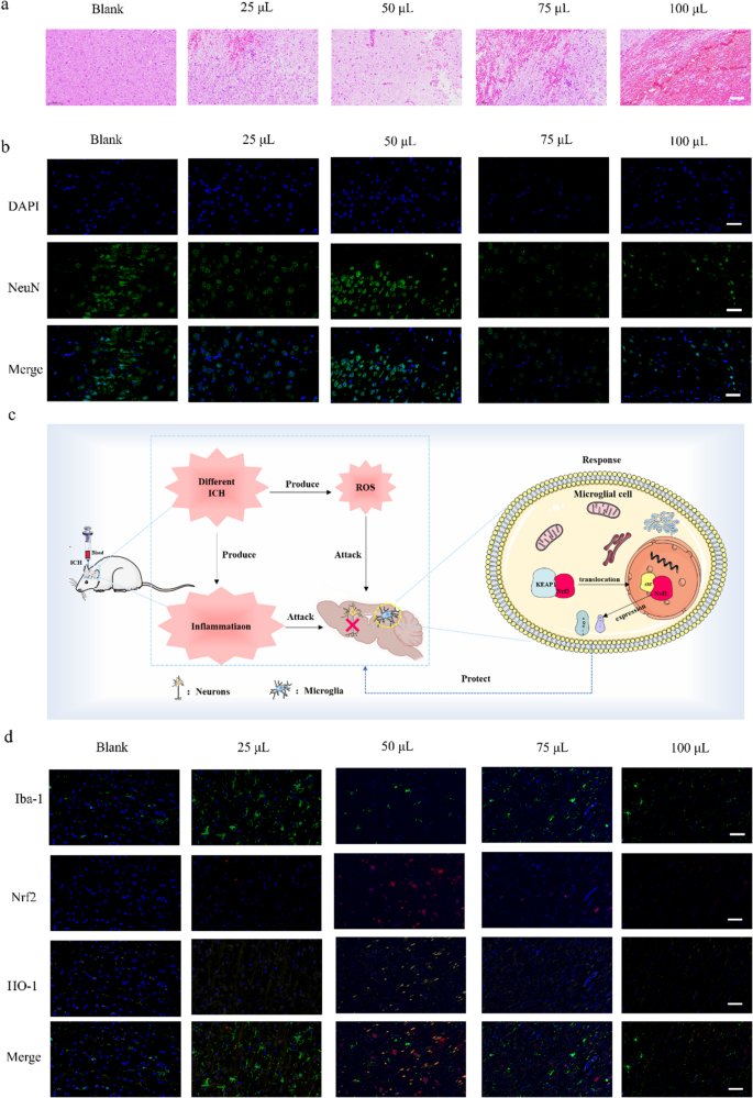 Nrf2-ARE signaling pathway-mediated protection in rat models of ...