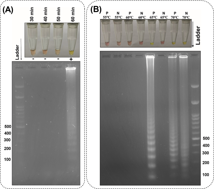 Loop-mediated isothermal amplification (LAMP) assay for early on-site ...