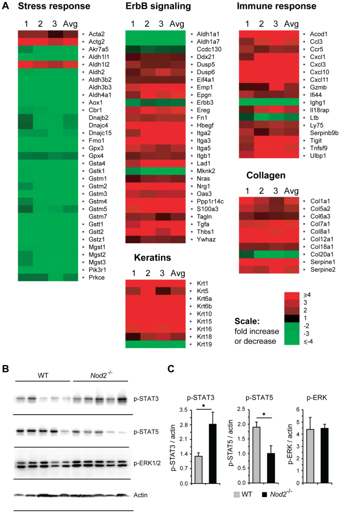 Innate immunity gene Nod2 protects mice from orthotopic breast cancer ...
