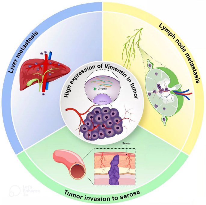 The prognostic and therapeutic potential of vimentin in colorectal ...