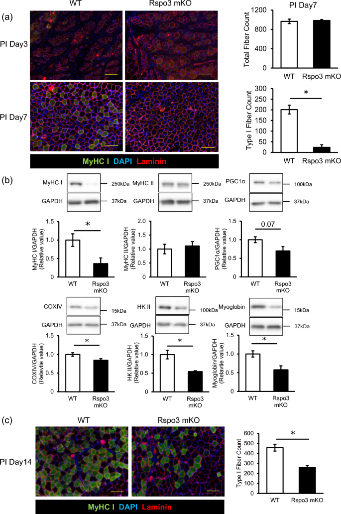 R-spondin 3 is a myokine that mediates type I fiber determination ...