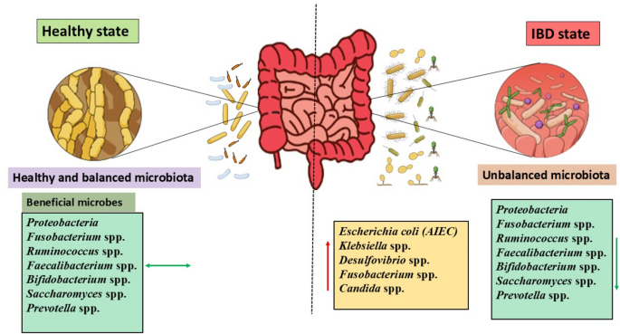 Gut microbiota and inflammatory bowel disease: mechanisms, clinical ...