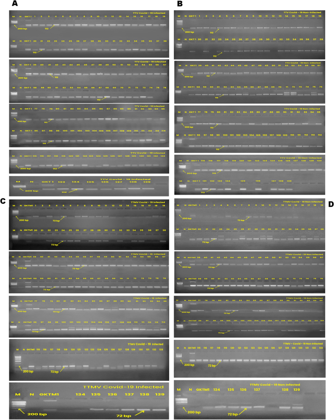 Comparative viral load analysis of torque Teno virus and Torque teno ...