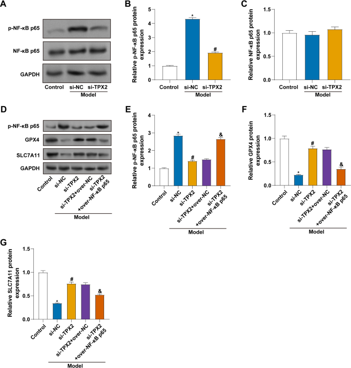 TPX2 promotes ferroptosis in LPS-induced C28/I2 chondrocytes via NF-κB ...