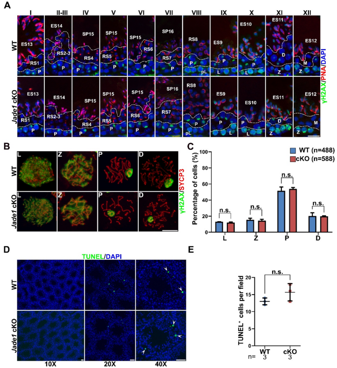 JADE1 is not essential for spermatogenesis and male fertility in mice ...