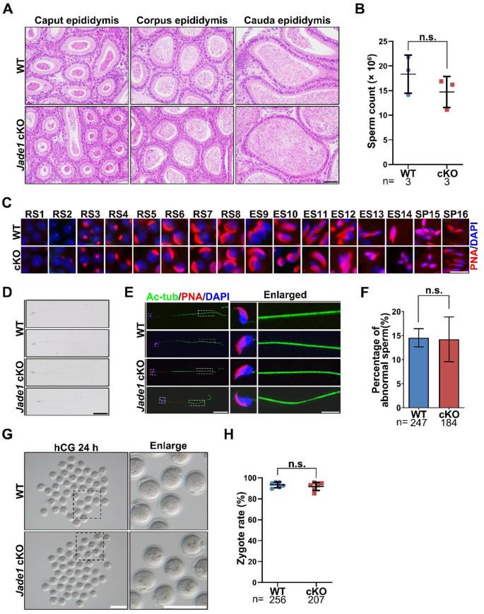 JADE1 is not essential for spermatogenesis and male fertility in mice ...