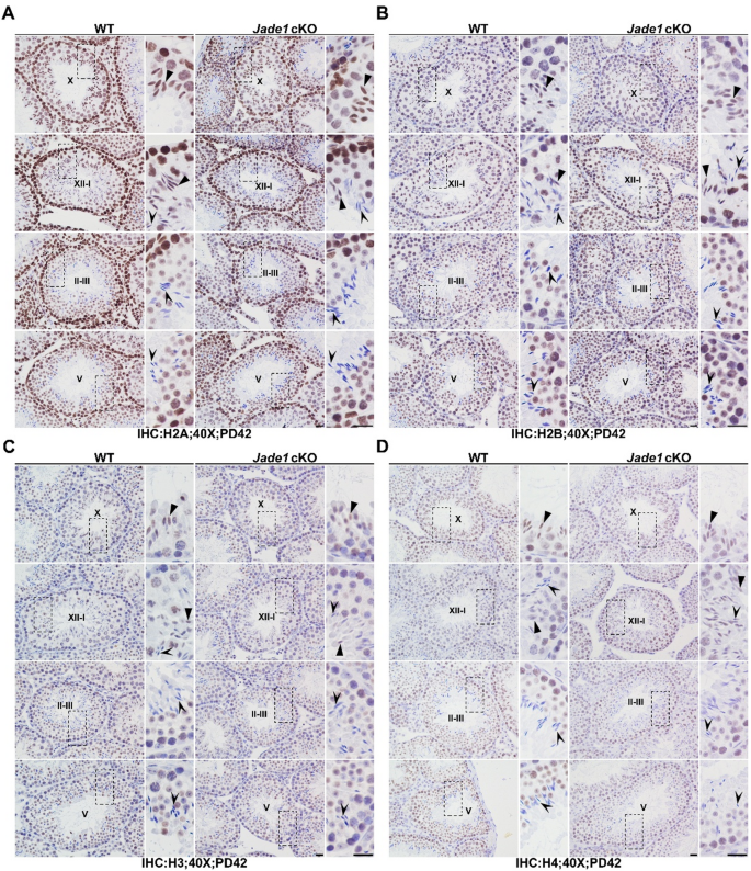 JADE1 is not essential for spermatogenesis and male fertility in mice ...