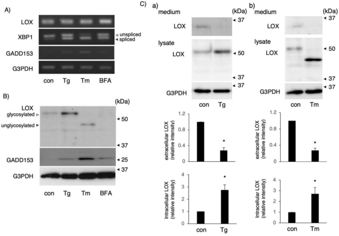 Loss of SEL1L or Hrd1 increases intrinsic LOX levels in HEK293 cells ...