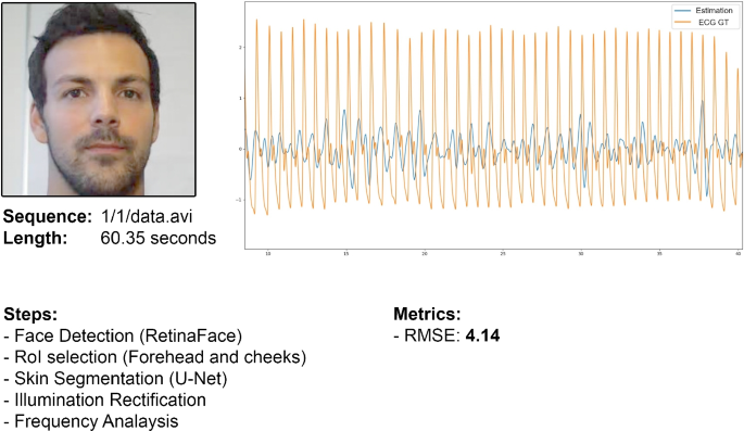 An image-processing toolkit for remote photoplethysmography ...