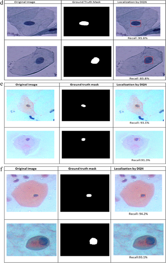 Active reinforcement learning based approach for localization of target ...