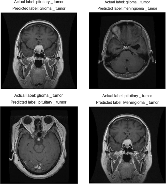 A fine-tuned transformer model for brain tumor detection and ...