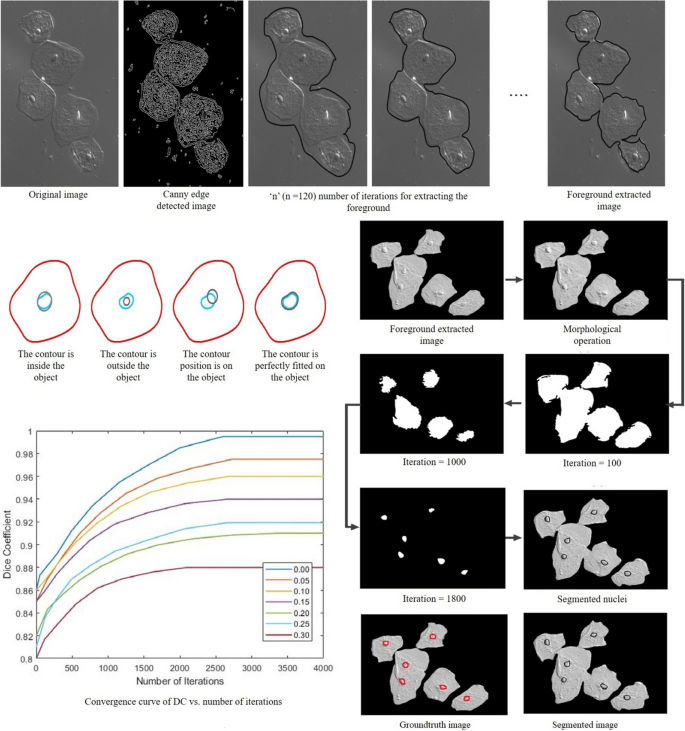VMAC: overlapping cervical cell segmentation from label-free ...