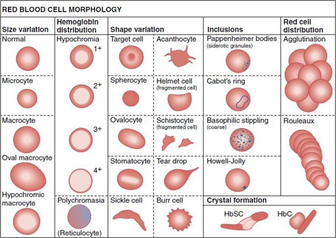 Red blood cell segmentation and classification using hybrid image ...