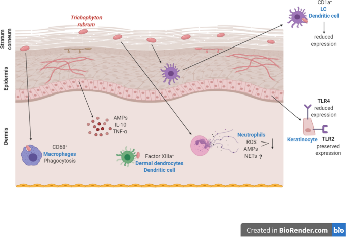 In Situ Expression of TNF-α and IL-10 in Human Dermatophytosis Lesions ...
