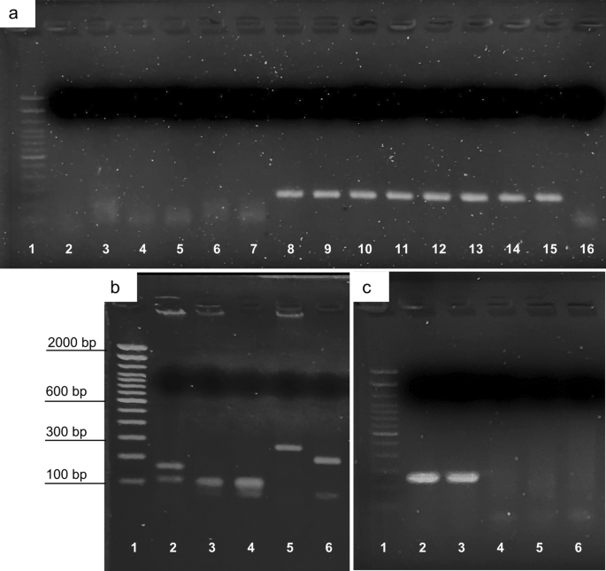 Partial Alpha-Tubulin Gene Amplification by Nested PCR in Fresh Biological Samples and Formalin ...