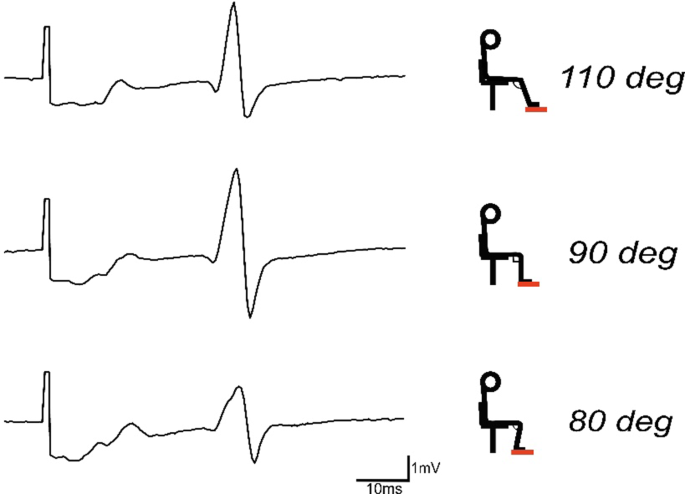 Movement- and force-dependent modulation of the h-reflex in human calf ...