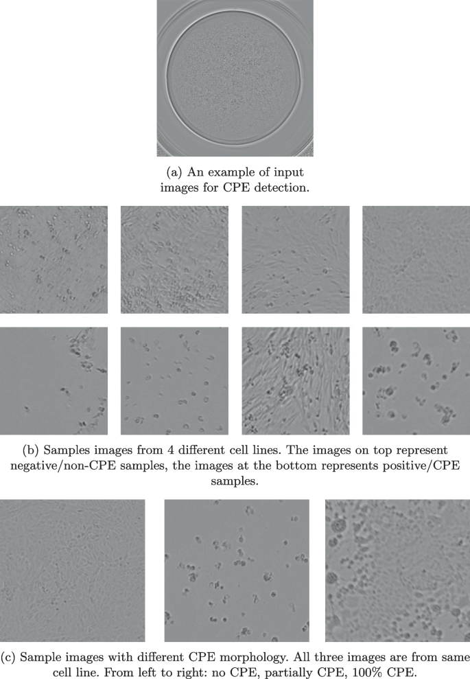 Cytopathic Effect Detection and Clonal Selection using Deep Learning ...