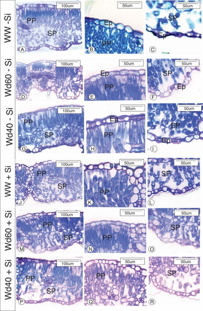 Silicon fertilization enhances the drought tolerance of soybean by ...