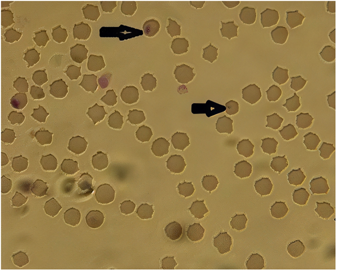 Theileria lestoquardi and malignant theileriosis in small ruminants: an ...