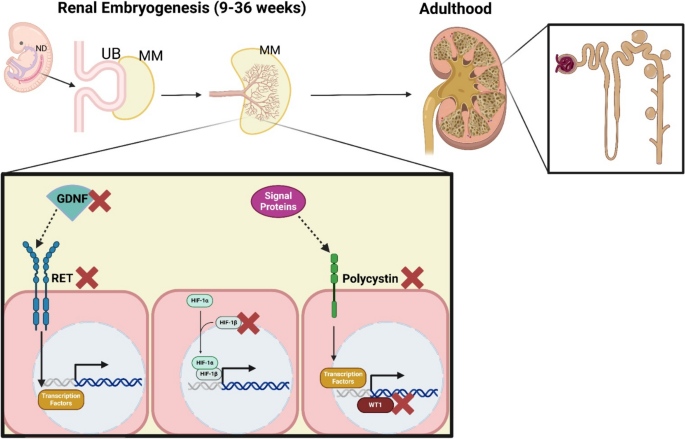 Porous perspectives: a comprehensive review of medullary sponge kidney ...