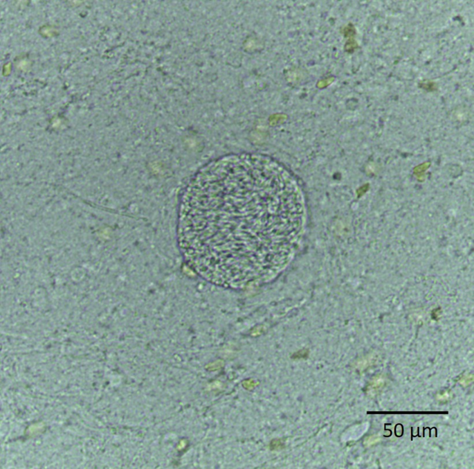Survival and viability of Toxoplasma gondii oocysts under natural dry ...