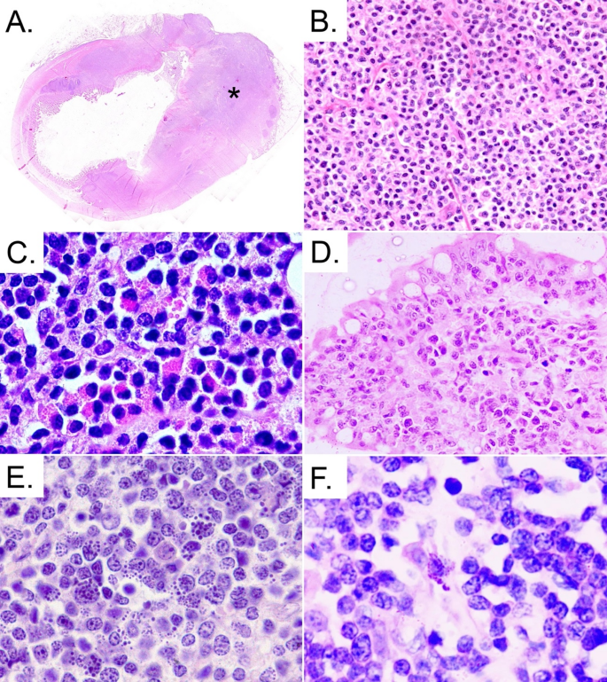 Clinical and pathological characterization of a feline intestinal large ...